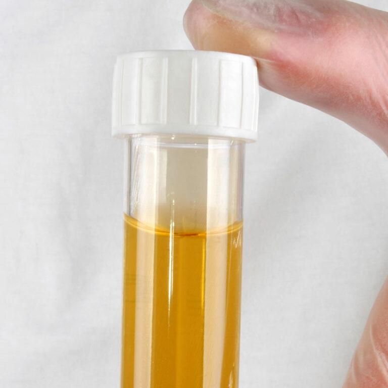 Focus Laboratories | UK based UTI testing and treatment